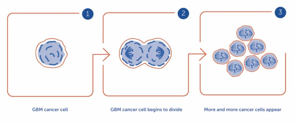 Novocure Tumor Treating Fields - Memorial Radiation Oncology Medical Group