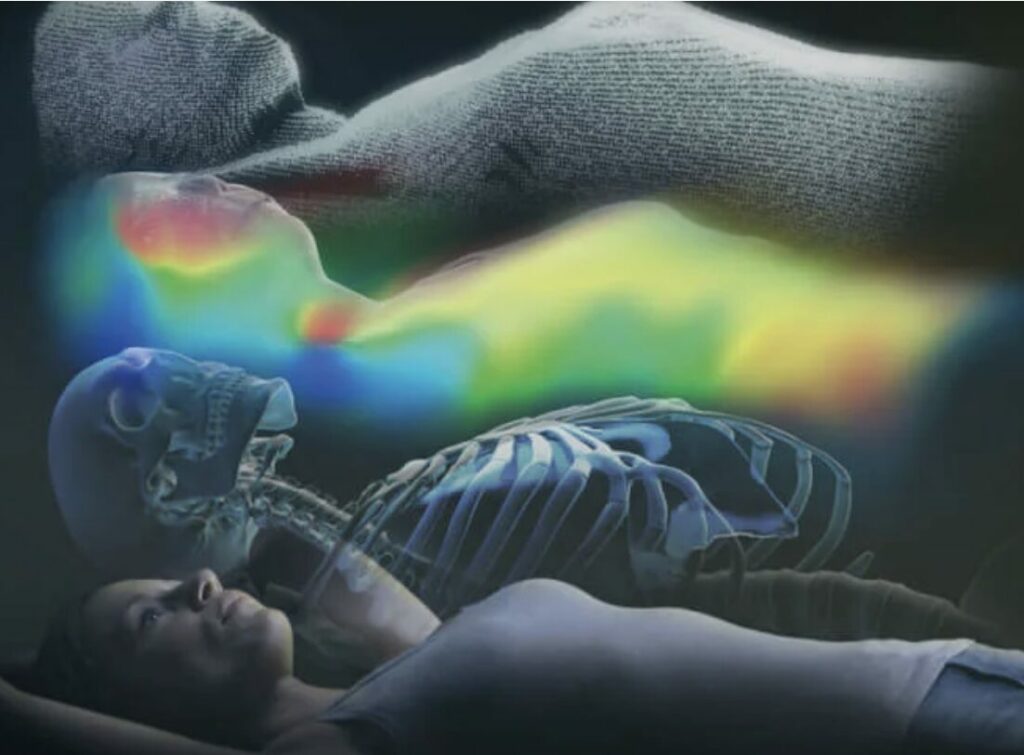 ViSurface Guided Radiation Therapy - Memorial Radiation Oncology ...